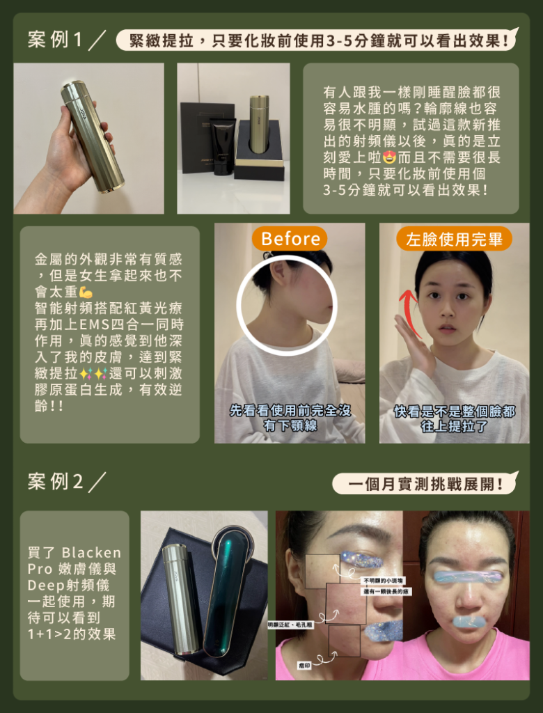 JOVS Deep 射頻深層拉提美容儀 ｜ 香港 台灣獨家販售 ｜一年保固